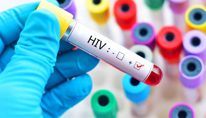 Why It’s Important To Get Tested & Know Your HIV Status