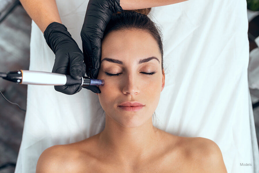 Microneedling 101 How It Works And How It Benefits Your Skin