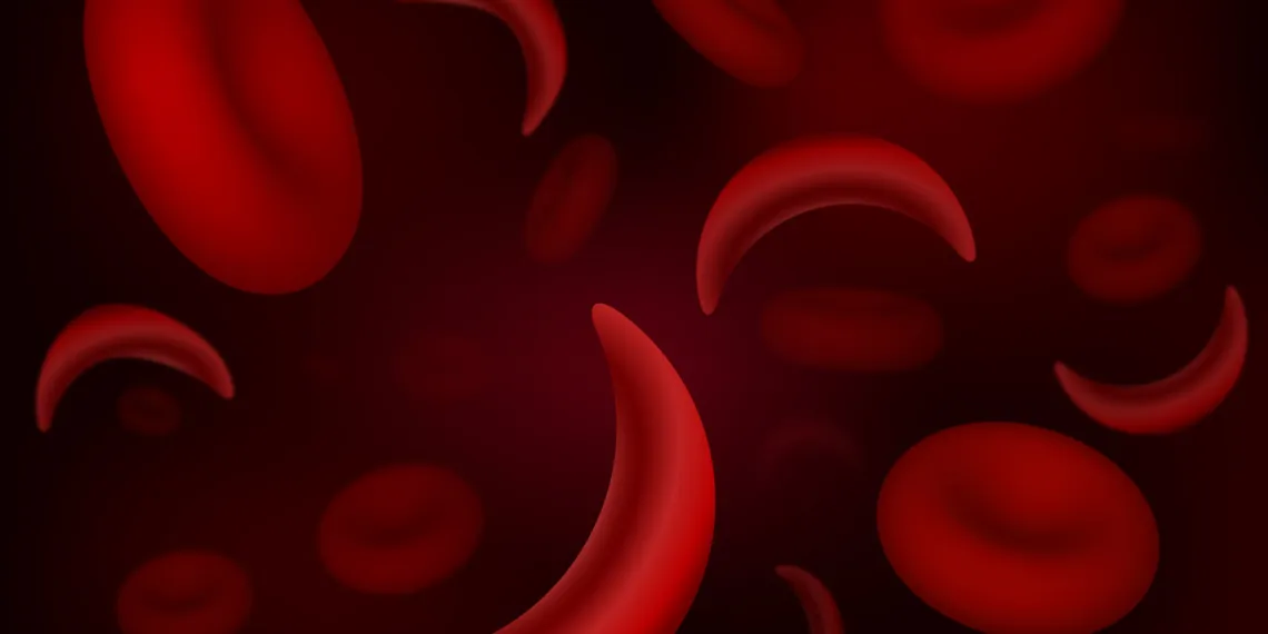 Have you heard of genotype AC? Here's what it means